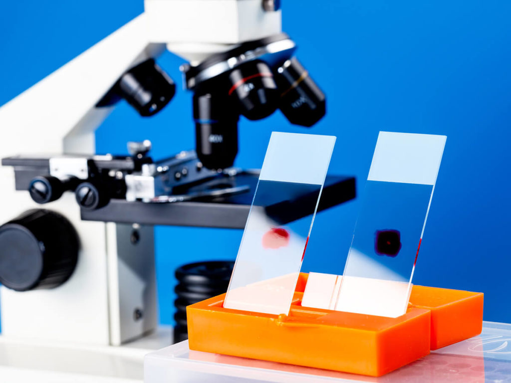 The importance of ITO slides - ITO Anti-Reflective Coatings